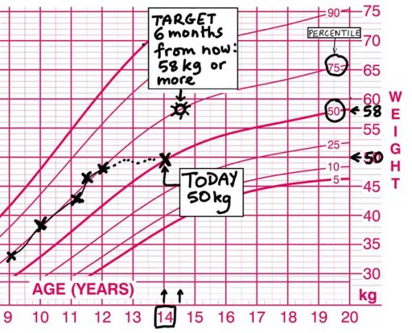 Is your child's target weight a gift to the eating disorder? One-Size ...